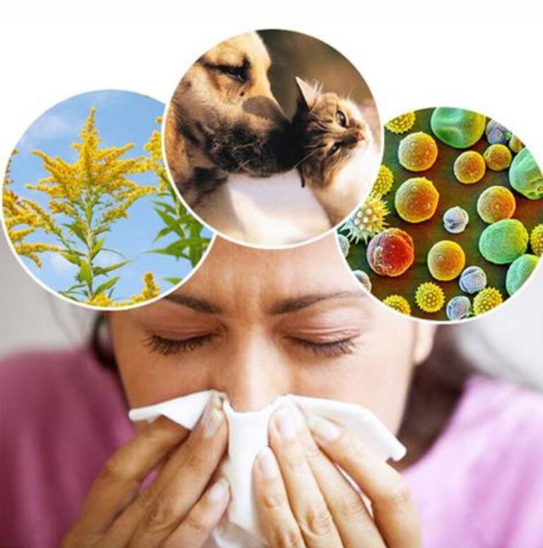 Conheça os tipos de rinites | Revista Camboriú